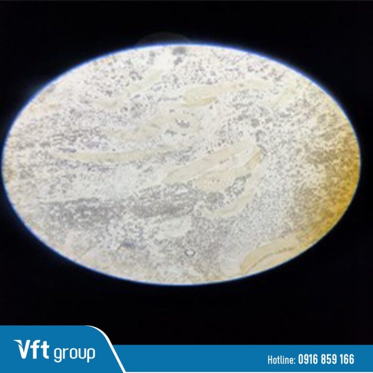 Làm Rõ Thực Hư Về Ký Sinh Trùng Vermiform Trong Nuôi Tôm - VFT